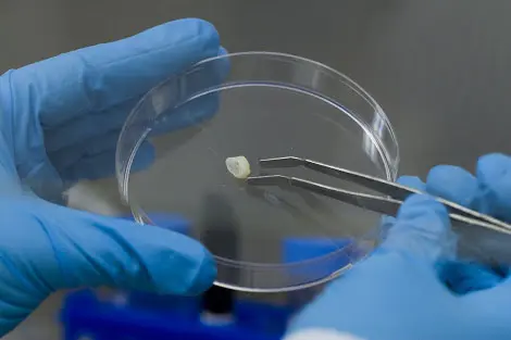 Harvesting Children’s Teeth - Dr. Roshan Rayen's Dental Clinic